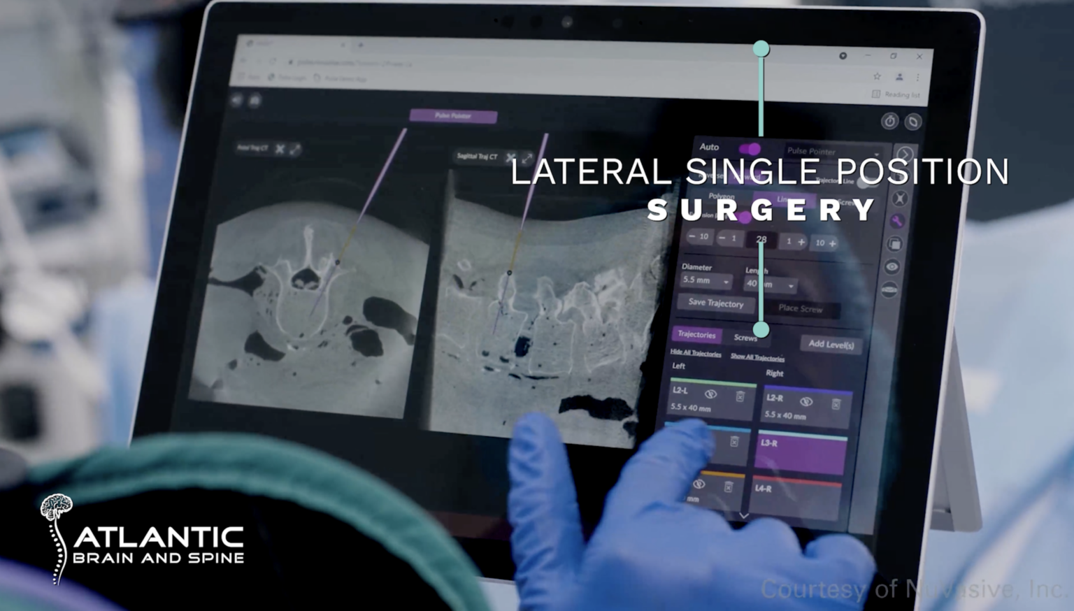 Atlantic Brain and Spine | NuVasive Pulse