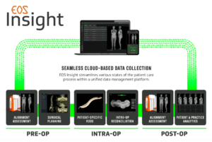 Atlantic Brain and Spine | EOS Technology