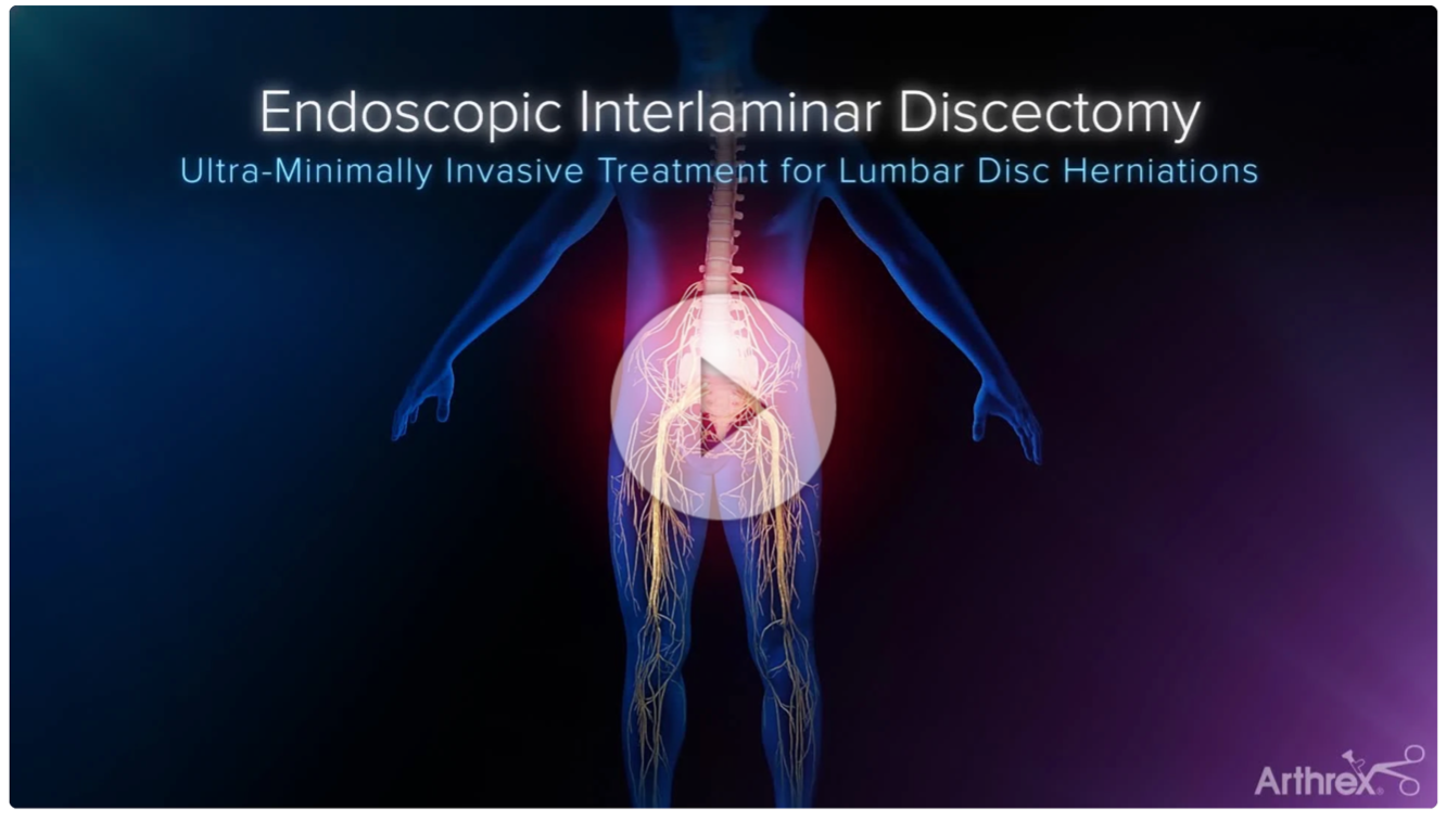 Atlantic Brain and Spine | Arthrex