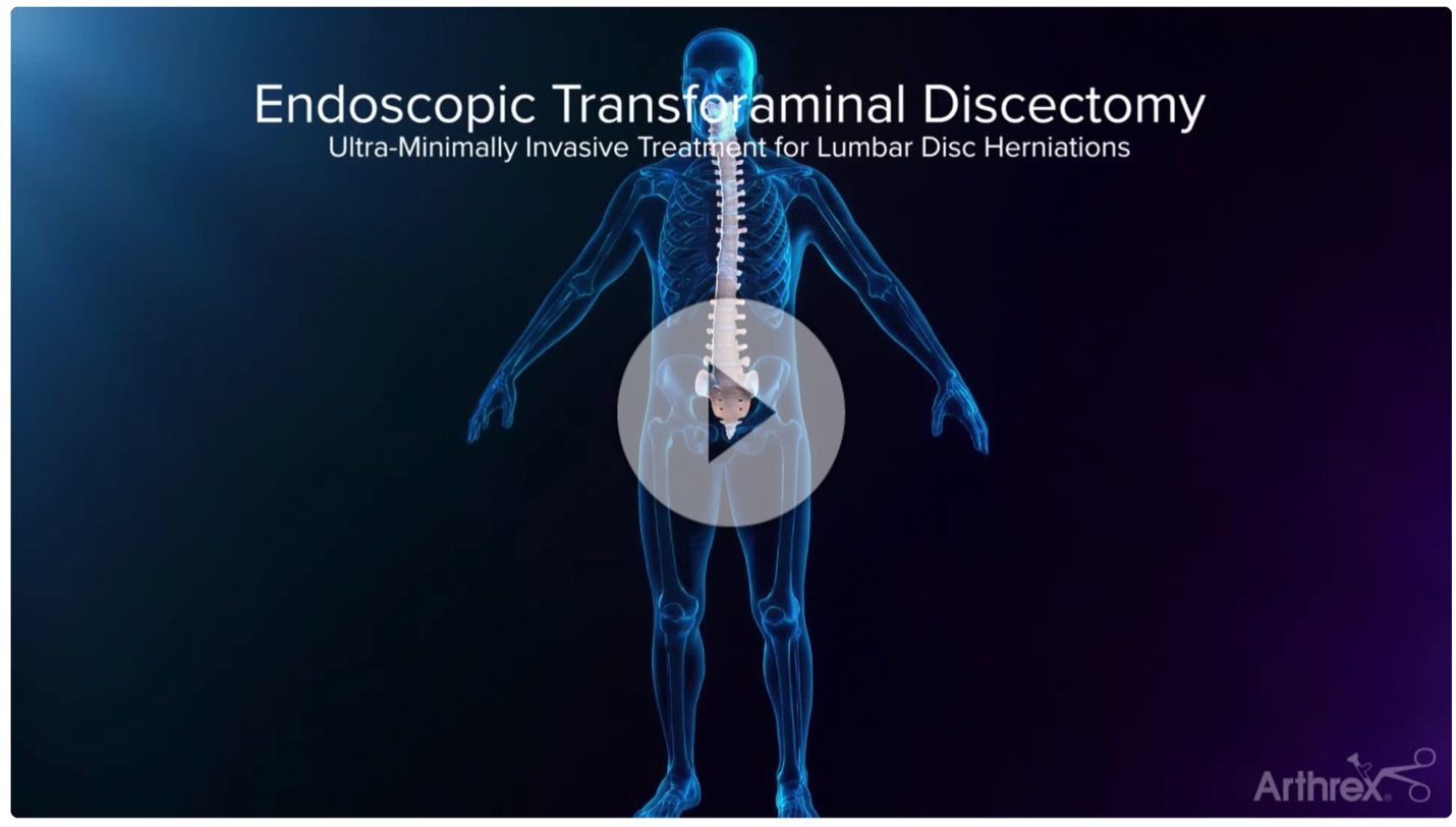 Atlantic Brain and Spine | Arthrex